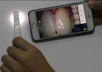 China Wi-Fi Intraoral Camera Digital Video Otoscope Camera Tooth Camera with Wi-fi Connected to Mobilephone for sale