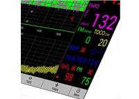 China Fetal / Maternal Monitor Multipara Patient Monitor Vital Monitor For Pregnant Woman Touch Screen Optional for sale