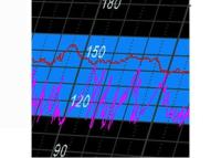 China Hospital Vital Signs Monitor Multi Parameter Patient Monitor Fetal Maternal Monitor With 12.1