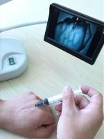 China Portable Focus Adjustable Vein Locator Device For Getting Clear Images for sale