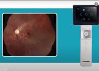 China Ophthalmic Equipment Digital Fundus Camera With 3.5