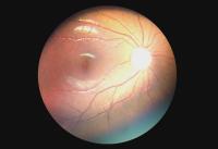 China Ophthalmic Device Digital Fundus Camera Opthalmoscope With Diopter of -20~+20D Video Resolution of 1280 X 960 for sale
