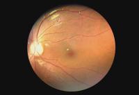 China Digital Diagnostic Set For Eye Digital Fundus Camera With Video Resolution of 1280 X 960 Pixels for sale