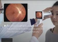 China Telemedicine In Ophthalmology Digital Fundus Camera View Angle of 45 Degree Optional Wifi Software For Report for sale