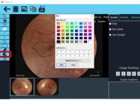 China Resolution 2560 X 1920 Pixels Digital Fundus Camera 40° Manual Focus Portable Fundus Camera for sale
