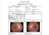 China Ophthalmoscope Portable Handheld Fundus Camera Telemedicine Available Video Resolution 1280 X 960 Pixels for sale