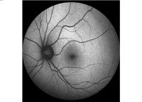 China Retina Angiograph Digital 160° Ophthalmic Equipment for sale