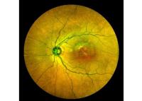 China Retina Angiograph Digital 160° Ophthalmic Equipment for sale