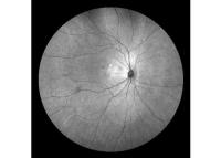 China Laser Scanning Fundus Camera Professional Opthalmic Equipment With Fundus imaging FOV 160°  Minimum Pupil Size 2 mm for sale
