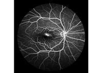 China Laser Scanning Fundus Camera Professional Opthalmic Equipment With Fundus imaging FOV 160°  Minimum Pupil Size 2 mm for sale