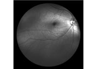 China Laser Scanning Fundus Camera Professional Opthalmic Equipment With Fundus imaging FOV 160°  Minimum Pupil Size 2 mm for sale