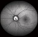 China Confocal Retina Opthalmoscope Digital Fundus Camera With FOV 15°, 30°, 60° Image Size 1024*1024 for sale