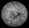 China Confocal Retina Opthalmoscope Digital Fundus Camera With FOV 15°, 30°, 60° Image Size 1024*1024 for sale