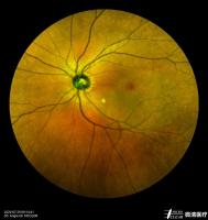 China 2mm 16fps Laser Scanning Digital Fundus Camera for sale