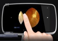 China Wifi APP Digital Fundus Camera With Internal Capacity 16GB for sale