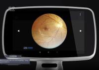 China Wifi APP Digital Fundus Camera With Internal Capacity 16GB for sale