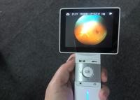 China CE Medical Digital Fundus Camera Resolution 1920 X 1080 Pixels for sale