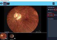 China 2560 X 1920 Pixels Digital Fundus Camera for sale