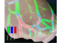 China Mini Handheld Vein Finder Vein Viewer With Near Infrared Light For Hospital for sale