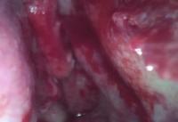 China 3 Inch Screen Portable ENT Camera For Examining Eardrum Nasal Cavity And Throat with 640*480 Resolution for sale