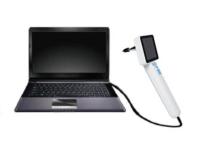 China Ear Camera Video Otoscopy 3 Inch LCD Digital Display Images Stored in Computer or Itself Waterproof IPX0 for sale