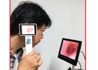 China Handheld ENT Endoscope Digital Medical Video USB Otoscope Camera With High Resolution 640 * 480 for sale