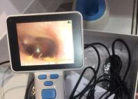 China 4 Natural White LED Medical Video USB Otoscope  Otoscopy With Image Stored in Computer Diameter of Lense 0.5cm for sale