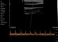 China Wifi Color Doppler Handheld Ultrasound Scanner Linear And Convex Connected To Mobilephone Android iOS Windows Supported for sale