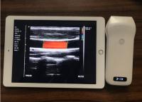 China Handheld Color Doppler Wirless Ultrasound Probe With Built - In Lithium Battery 7.5-10MHz Freqency 46mm Length for sale