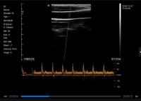 China Pocket Wireless Ultrasound Probe Handheld Ultrasound Probe Mini Ultrasound Only 235g Weight 128 Elements 2.4G Wifi for sale