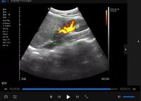 China Wireless Ultrasound Probes Handheld Ultrasound Device With B, B/M, Color Doppler, PW, Power Doppler Mode 192 Elements for sale