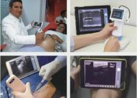 China Ipad Handheld Ultrasound Scanner Portable Color Doppler Abdominal Vascular Pediatrics Gynecology Application for sale