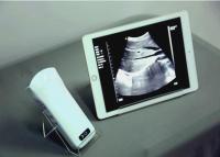 China Digital Mobile Handheld Portable Ultrasound Device Convex + Linear + Cardiac 3IN1 Wireless Ultrasound Transducer for sale