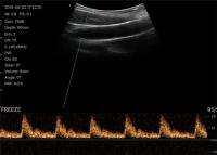China Pocket Handheld Ultrasound Scanner With Wifi Connected To IPad Mobilephone Doppler Ultrasound Portable 128 Elements for sale