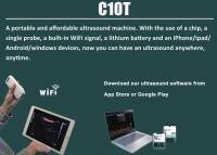 China 5G Wifi Handheld Ultrasound Scanner Pocket Ultrasound Built - in 4200mAh Lithium Battery Wireless Charger Supported for sale