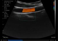 China Affordable Wireless Portable Ultrasound Handheld Ultrasound Scanner 5G Wifi Connected 128 Elements Standby time >=12h for sale