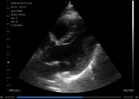 China Digital Wireless Handheld Ultrasound Scanner for sale