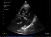 China 5G Handheld Ultrasound Scanner for sale
