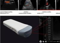 China IOS Android Windows Handheld Portable Ultrasound Device Convex Linear Cardiac 3 IN 1 Ipad Ultrasound Probe for sale