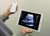 China Ultrasound Color Doppler Diagnostic Ultrasound Equipment Download Software From App Store or Google Play 3 In 1 Wireless for sale