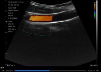 China Colour Doppler Ultrasound Scanner Doppler Ultrasound Device With 128 Elements 13 Applications B BM Color PDI PW Mode for sale