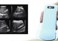 China Home Doppler Ultrasound Portable Diagnostic Hand held Doppler Ultrasound Obstetric Gynecology Pediatrics Application for sale