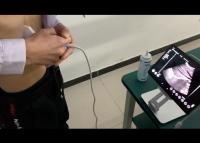 China Usb Ultrasound Probe Android IOS Windows All Available Primary Care Handheld Ultrasound Scanner With 6 Languages for sale