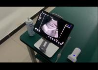 China Pocket Ultrasound Hand held Ultrasound Scanner With B, B/M, Color Doppler, PW, Power Doppler Mode 128 Elements for sale