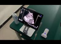 China Laptop 1350mah Battery 12h Handheld Ultrasound Scanner USB Ultrasound Probe Android 128 Elements for sale
