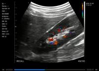 China 7.5MHz WiFi Palm Color Doppler Ultrasound Scanner for sale