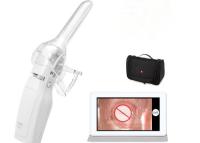 China Cervix Camera Video Camera for Vaginal Handheld Digital Mini Colposcope Self - Inspection with 1.5 Times Magnification for sale