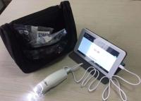 China Monitor Treatment and Prevent Recurrence Digital Electronic Colposcope Self - Inspection for sale
