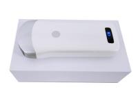 China 80 Elements Battery Lasts 3 Hours Ipad Ultrasound Scanner for sale