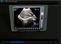 China Pocket Convex 3.5mhz Linear 7.5mhz / 10mhz Handheld Ultrasound Scanner for sale